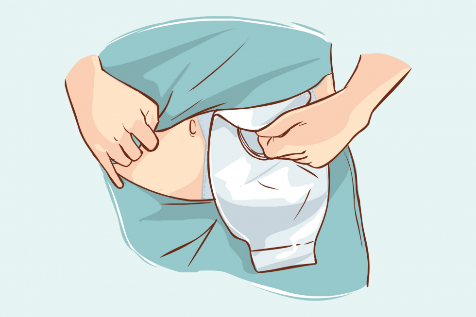 Colostomy Care Procedure