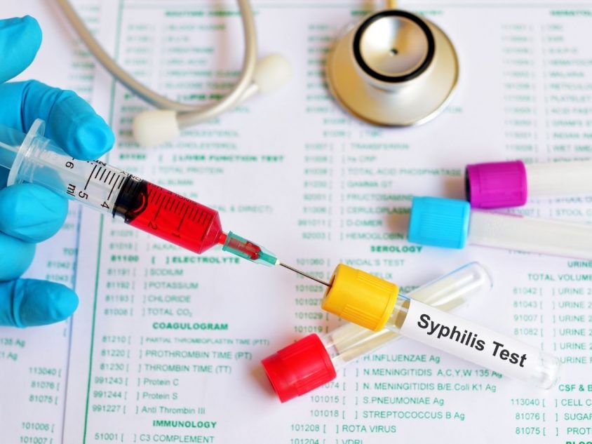 Syphilis 101: Symptoms, Causes, Diagnosis & Treatment - Homage Malaysia